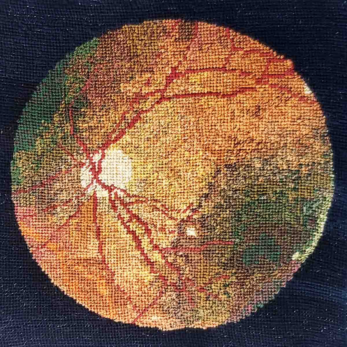 Georgie KAPALA | Retina Project